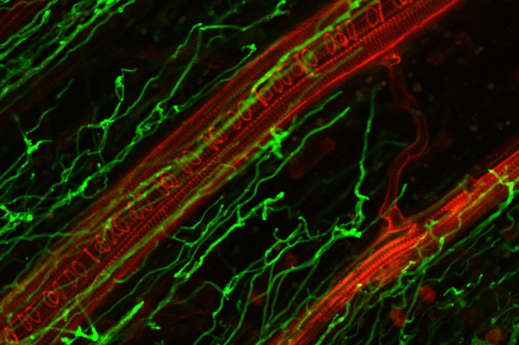 Dual lifestyle plant fungus turns ally, protecting cereal crops against ...